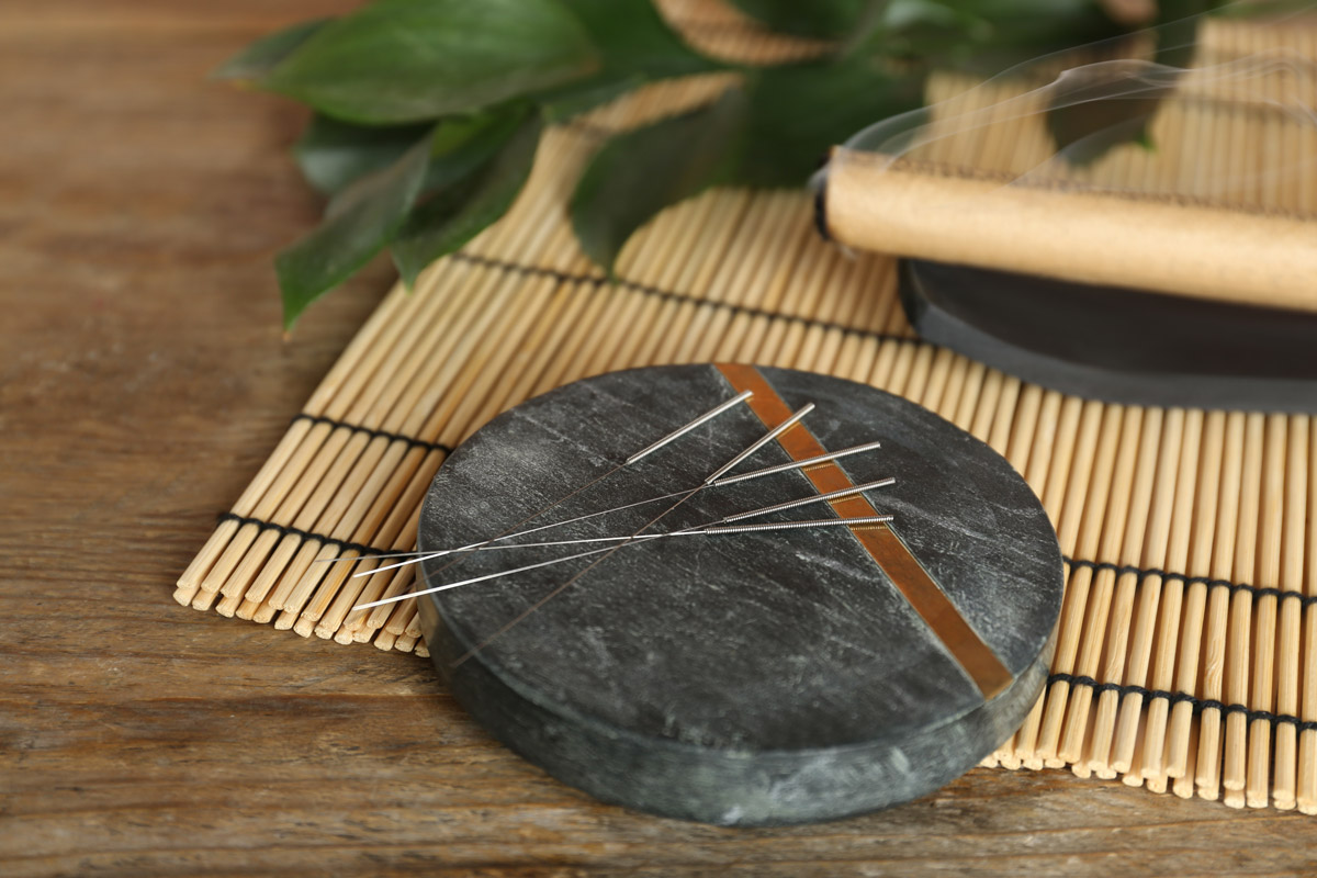 Acupuncture – Jade Roots Acupuncture